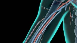 Brachial Artery: Definition, Artery Branches, Traumatism, Thrombosis ...