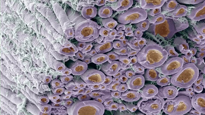 Sphingomyelin: Definition, Physical Characteristics, Metabolism ...