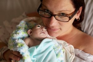 Acrania: What is it? Causes, Symptoms, Diagnosis and Treatment - Scope Heal