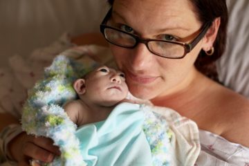 Acrania: What is it? Causes, Symptoms, Diagnosis and Treatment - Scope Heal