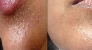 Androgen: Definition, Types, Examples, Biological Function, Biological ...