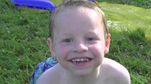 Angelman syndrome: What is it? Symptoms, Causes, Treatment and ...