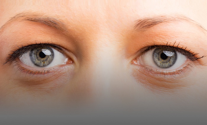 Anisometropia: Types, Symptoms, Causes and Treatment - Scope Heal
