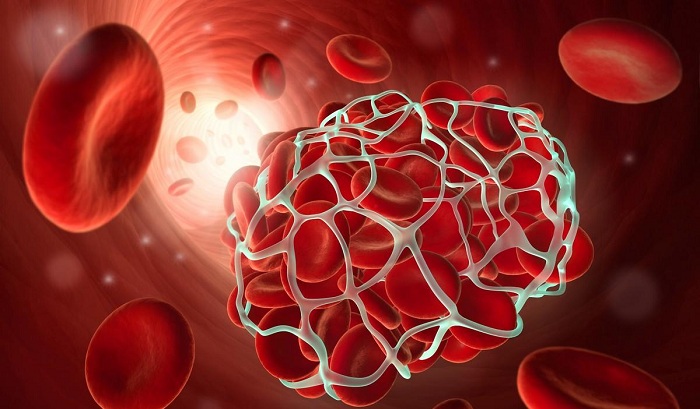 What is Anticoagulant Therapy: Medication, Pathologies, Ways of ...