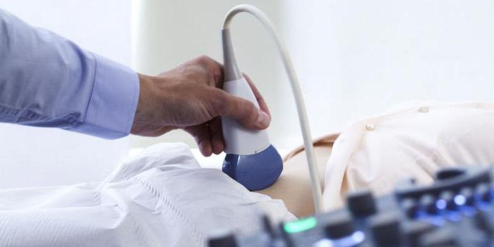 Coledoco Conduit: What is it? Clinical Significance, Spontaneous ...