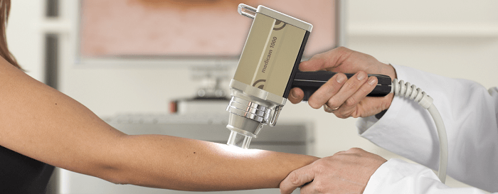 Digital Dermatoscopy: What is it? Uses, Dermoscopic Strategies and ...