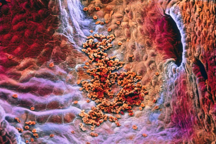 Endocardium: What is it? Types of Layers, Functions and Associated ...