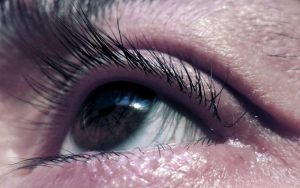 Escotoma: Definition, Symptoms, Causes, Treatment, Hatch, Diagnosis and ...