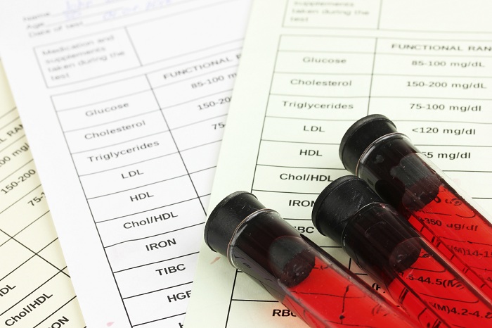 Fenofibrate: Formula, Presentation, Indications, Mechanism of Action ...