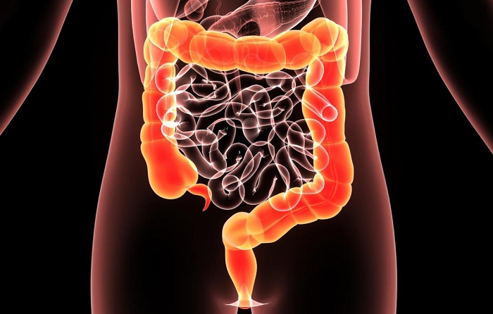 Hemicolectomy Types Considerations Risks Diet Recovery And hemicolectomy-types-considerations-risks-diet-recovery-and