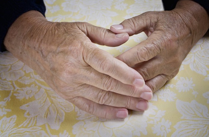 Histidine: Structure, Characteristics, Benefits, Deficiency and Natural ...