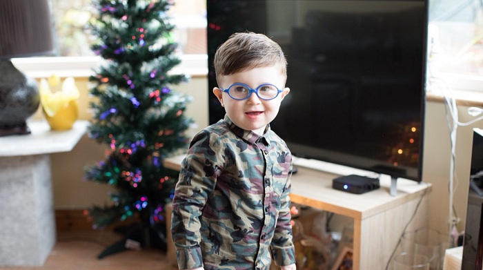 Homocystinuria: Symptoms, Causes, Diagnosis, Treatment and Prognosis ...