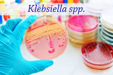 Klebsiella SPP: General, Pathophysiology and Treatment - Scope Heal