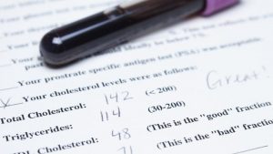 Mixed Hyperlipidemia: Symptoms, Risk Factors, Diagnosis, Treatment ...