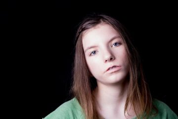 Moebius syndrome: Symptoms, Causes, Related Disorders, Diagnosis and ...