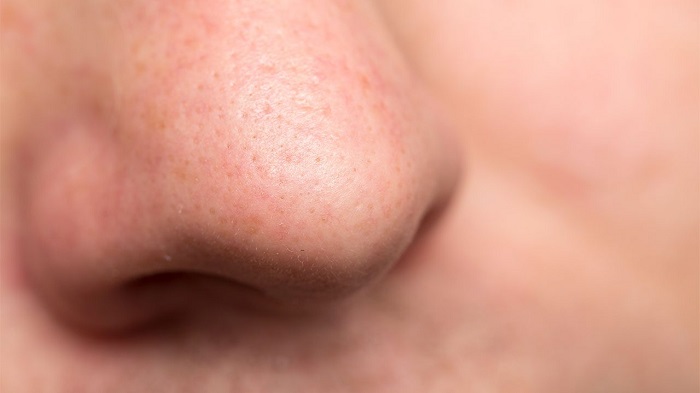 Nasal Pits: Anatomy, Function, Epithelial Cells and Diseases - Scope Heal