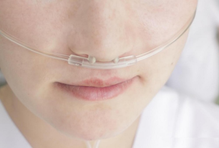 Periacal Cyanosis: Definition, Causes and Treatment - Scope Heal