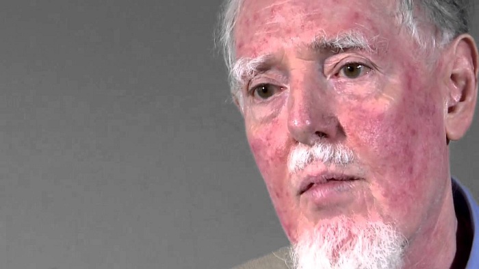 Porphyria: What is it and what are its characteristics? - Scope Heal