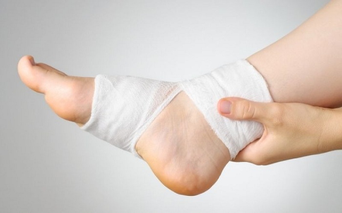 Pressure Ulcers: Causes, Classification, Treatment, Risk Factors ...