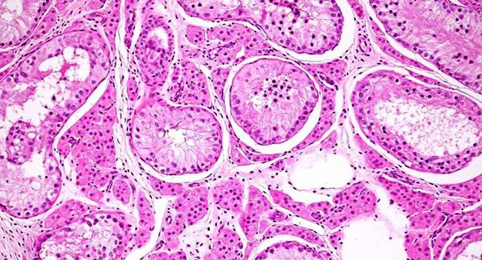 Sertoli Cells: Definition, Structure, Mode of Action and Related ...