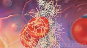 Shock or Distributive Shock: Types, Pathophysiology, Prognosis and ...