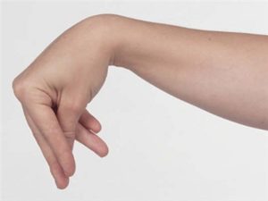 What is Tetania: Symptoms, Causes and Treatment - Scope Heal