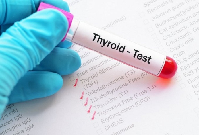 Triiodothyronine: What is it? How is it controlled? Related Disorders ...