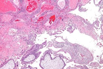 Trophoblast: Definition, Importance, Cell Lines, Lesions and ...