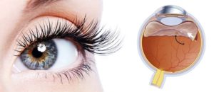 Vitreo: What is it? Structure, Anatomical Characteristics, Biochemical ...