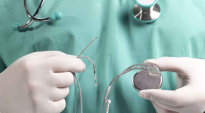 The Beck Triad: Pathology, Risk Factors, Symptoms and Diagnosis - Scope ...