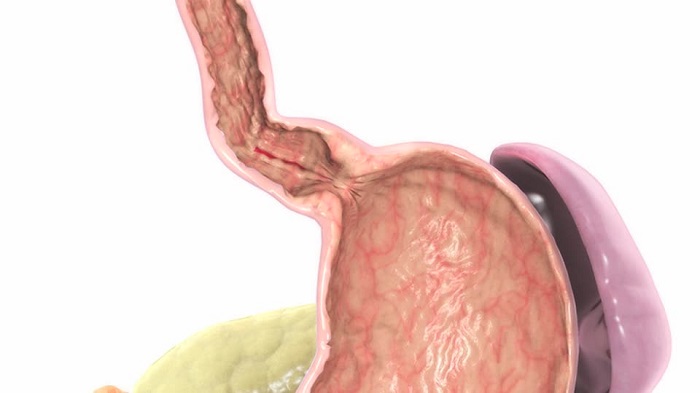 Cinitapride: Formula, Presentation, Indications, Mechanism of Action ...