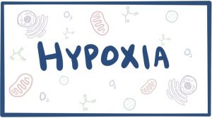 What is Hypoxia: Types, Causes, Symptoms, Complications, Diagnosis ...