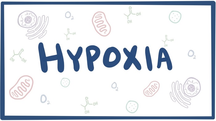What is Hypoxia: Types, Causes, Symptoms, Complications, Diagnosis ...