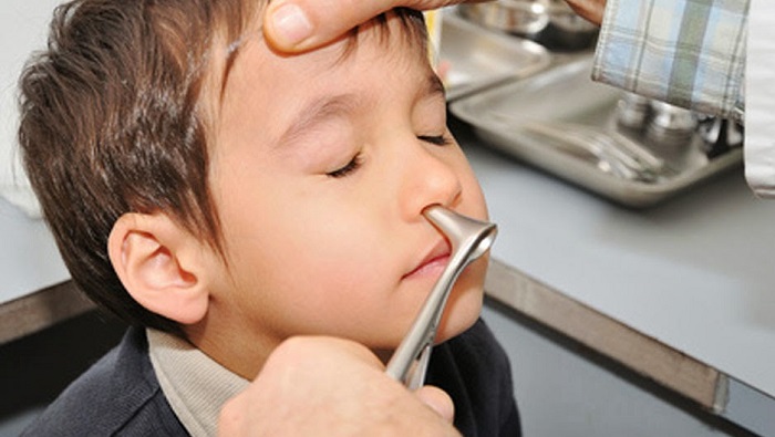 Rinoscopia: Objective, Methodology, Preparation, Complications and ...