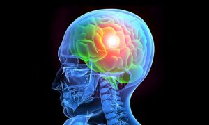 Adrenoleukodystrophy: What is it? Risk Factors, Types, Causes, Symptoms ...