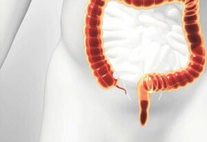 Function of the Appendix: Definition, Functions, Problems Associated ...